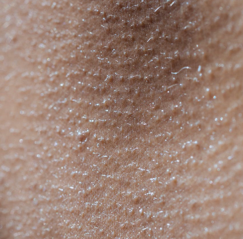 5 facts to know about goosebumps 😨 – 3H:health,happiness,healing